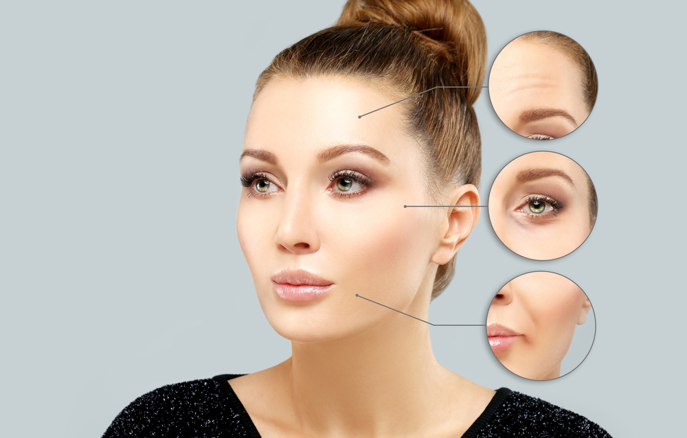 BOTOX: do I like it, love it or can`t live without it? - Carlisle ...